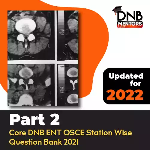 Exams DnbMentors Online DNB ENT Mock OSCE Tests